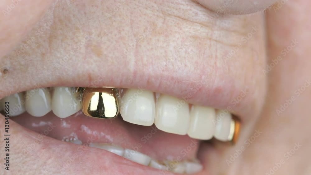 Mouth of elderly woman with false teeth. Close up Stock Video | Adobe Stock