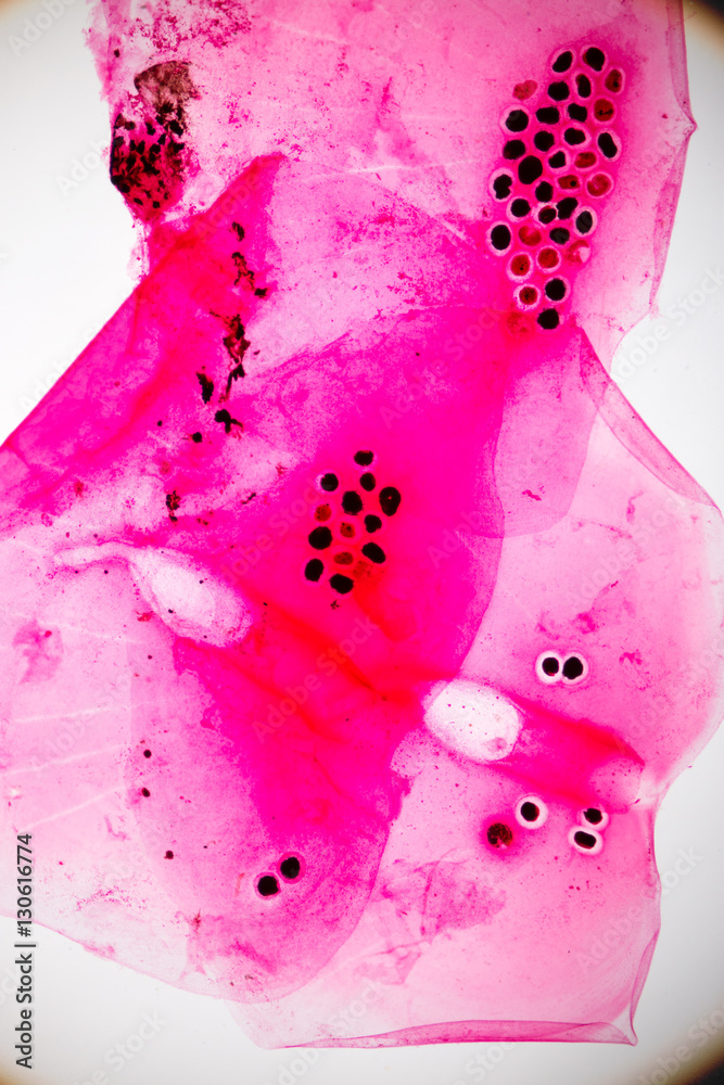 Foto de Metacercariae stage parasite on slide under microscope view. do ...