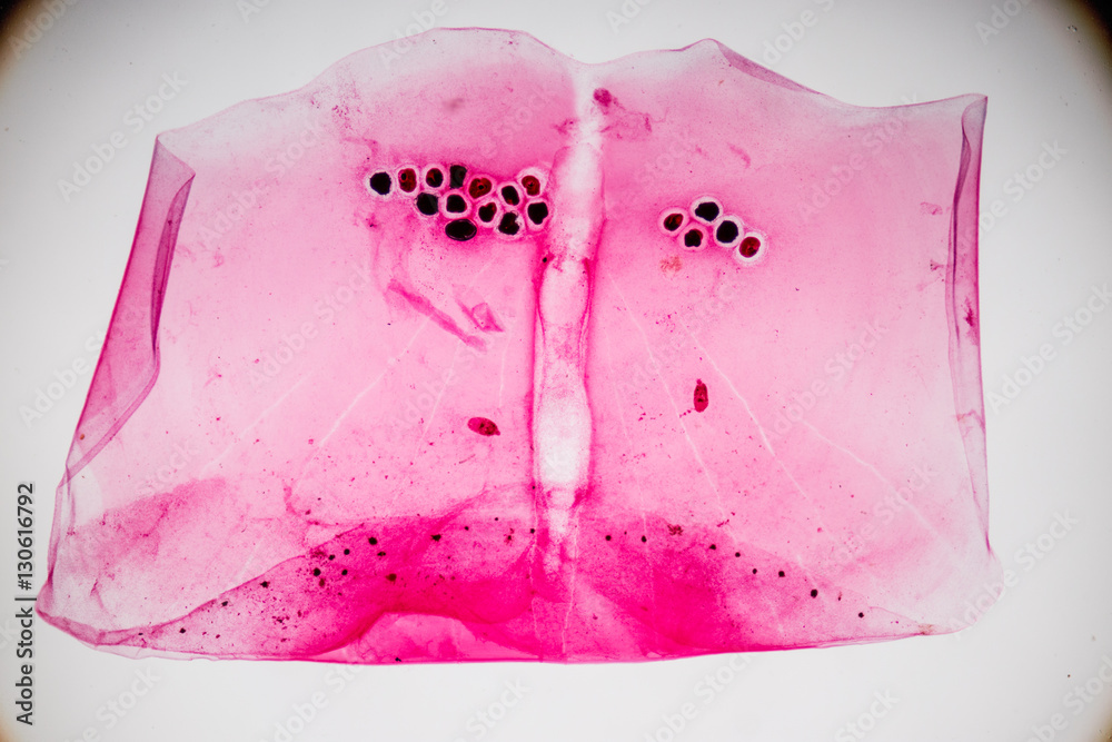 Metacercariae stage parasite on slide under microscope view. Stock ...