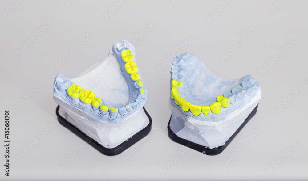 Technical shots on a dental prothetic laboratory Stock Photo | Adobe Stock