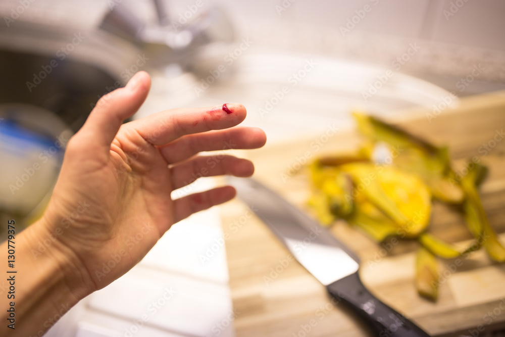 Ouch! Woman cut her finger while cooking a dinner in her kitchen. Stock ...