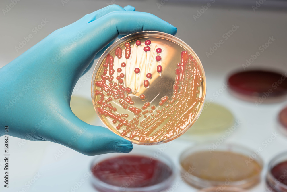 Escherichia Coli Colonies Gram Negative Bacilli Colonies As Tes Stock