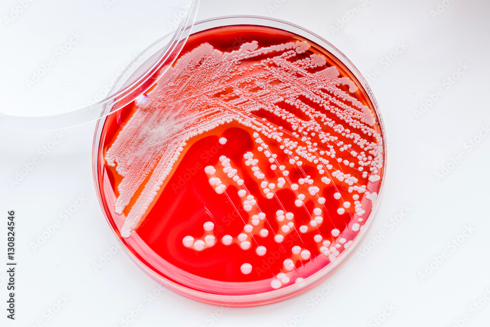 Staphylococcus aureus. Stock Photo | Adobe Stock