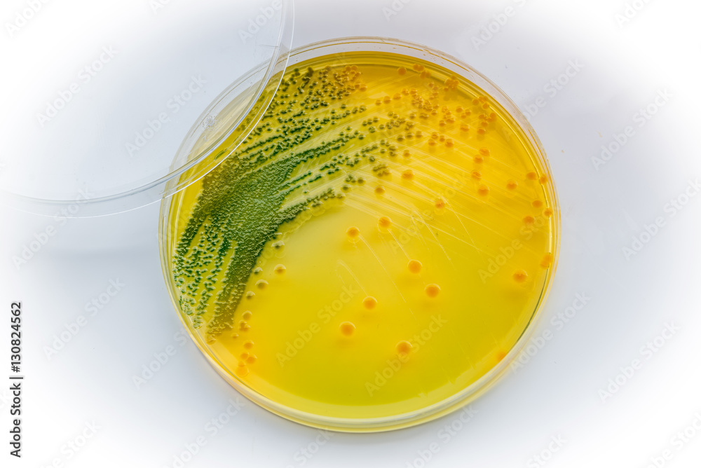 Vibrio cholerae:Gram-negative, comma shaped bacterium. Stock Photo ...