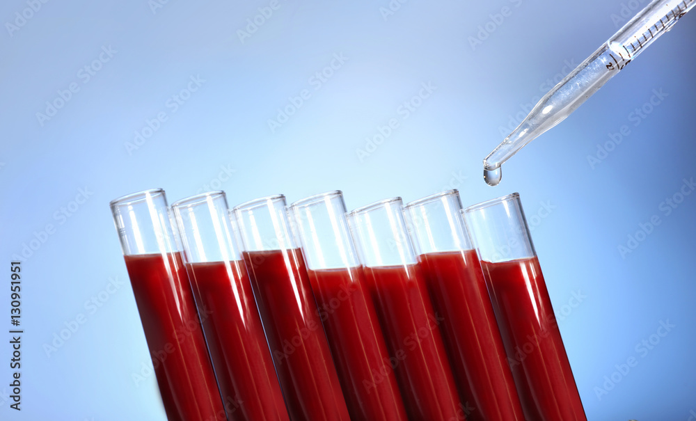 Test tubes filled with blood and glass dropper on blue blurred ...