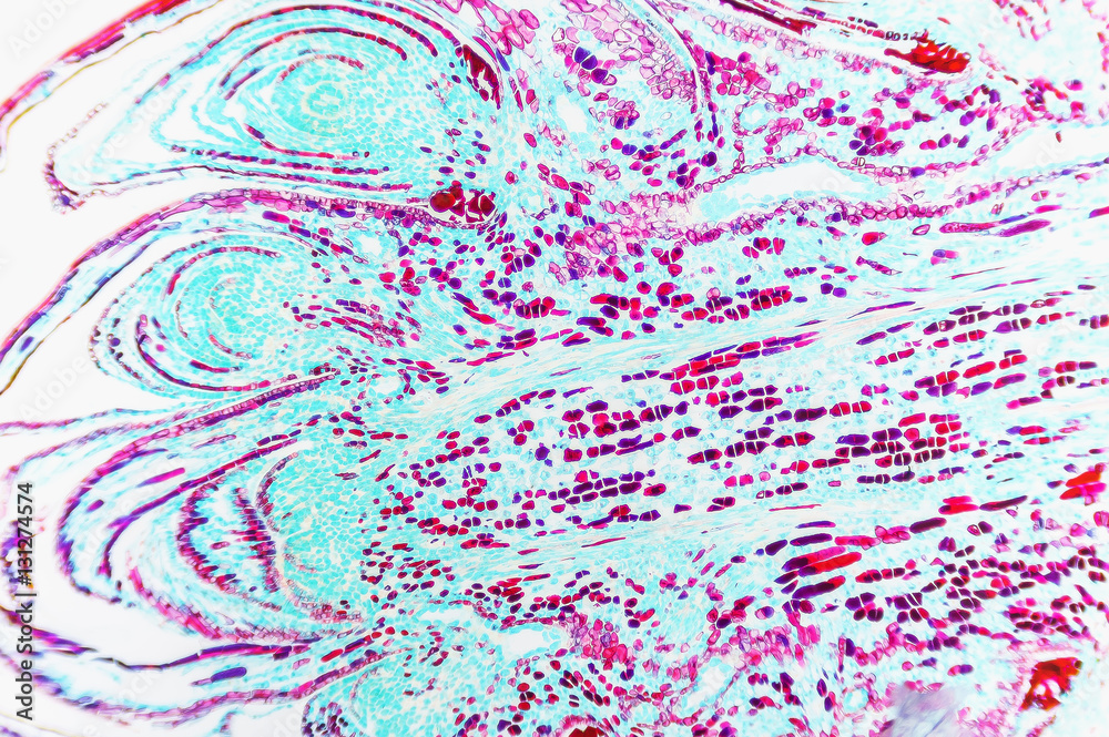 Cell Pinus Female Strobile LS Stock Photo | Adobe Stock