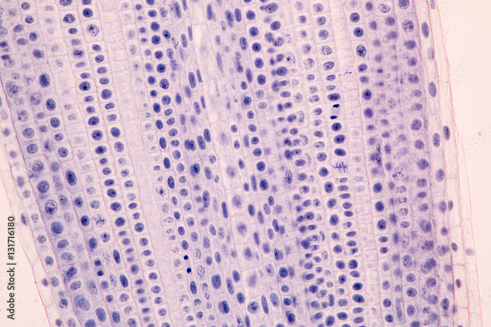 Root tip of Onion and Mitosis cell in the Root tip of Onion under a ...