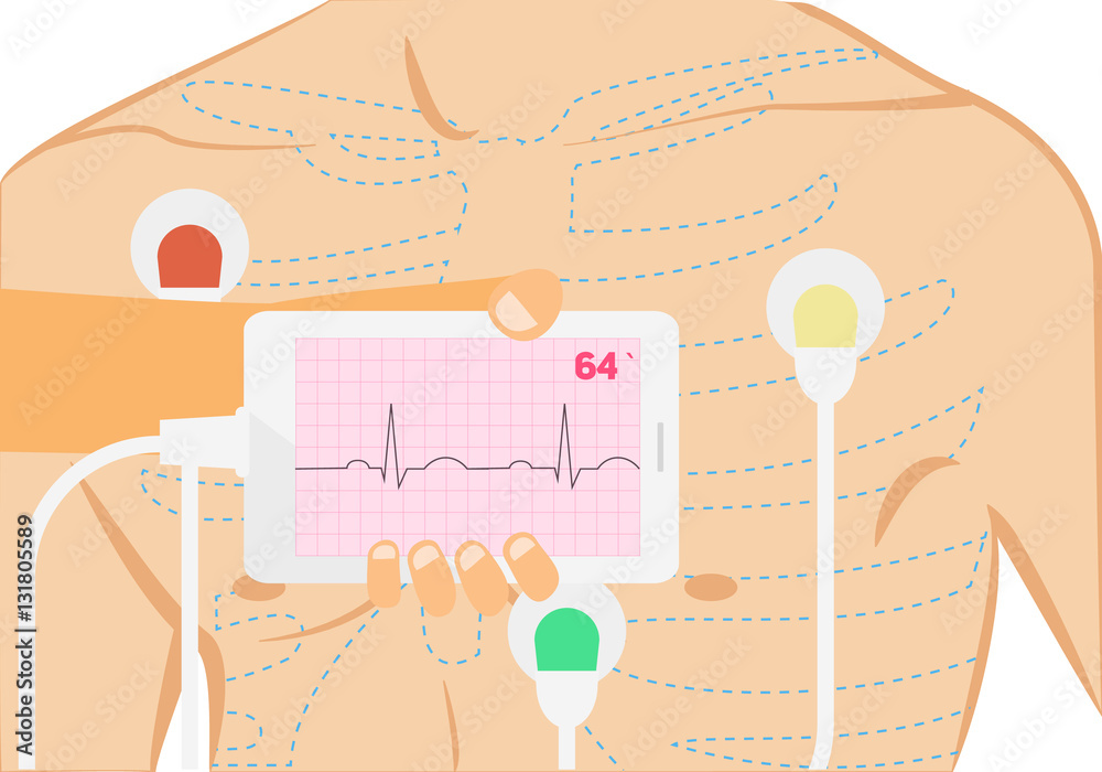 Mobile ecg conceptual illustration. Hand holding smartphone with ecg ...