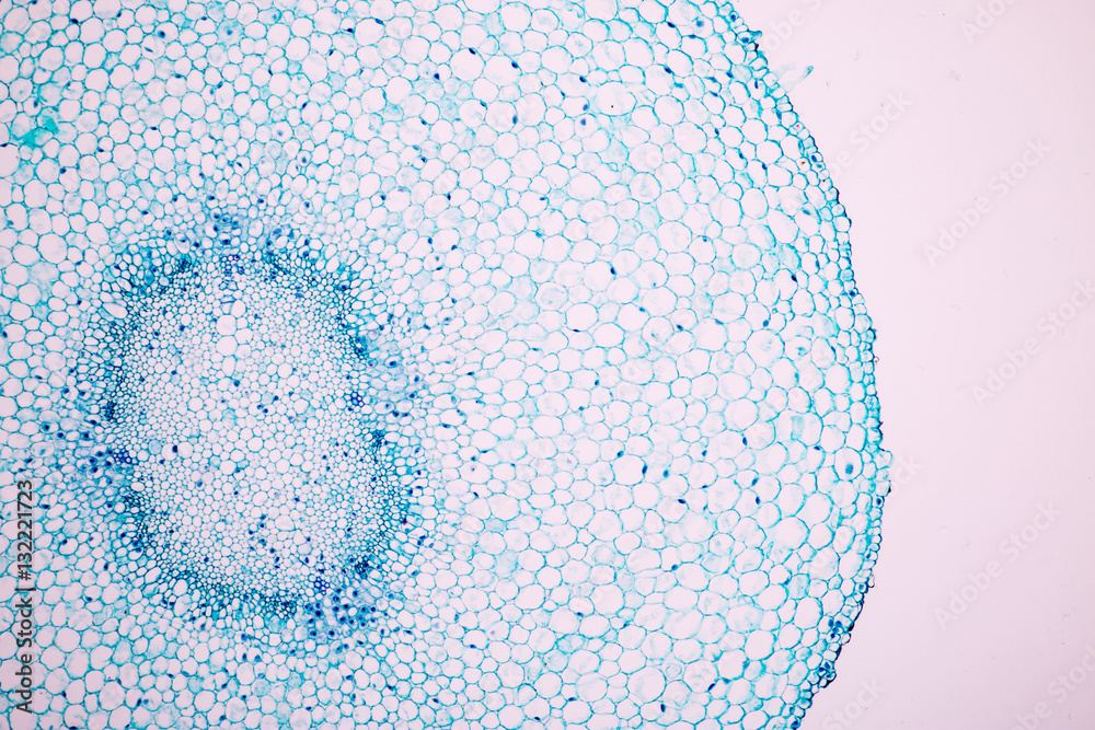 Root and Typical Dicot on the slide under microscope view. Stock Photo ...