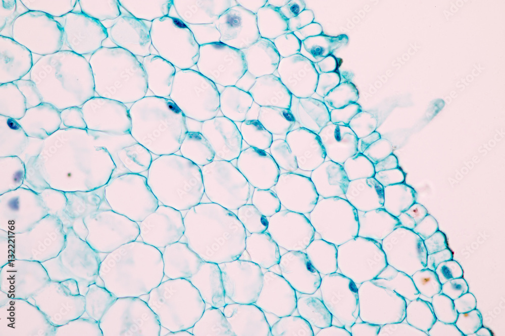 Root and Typical Dicot on the slide under microscope view. Stock Photo ...