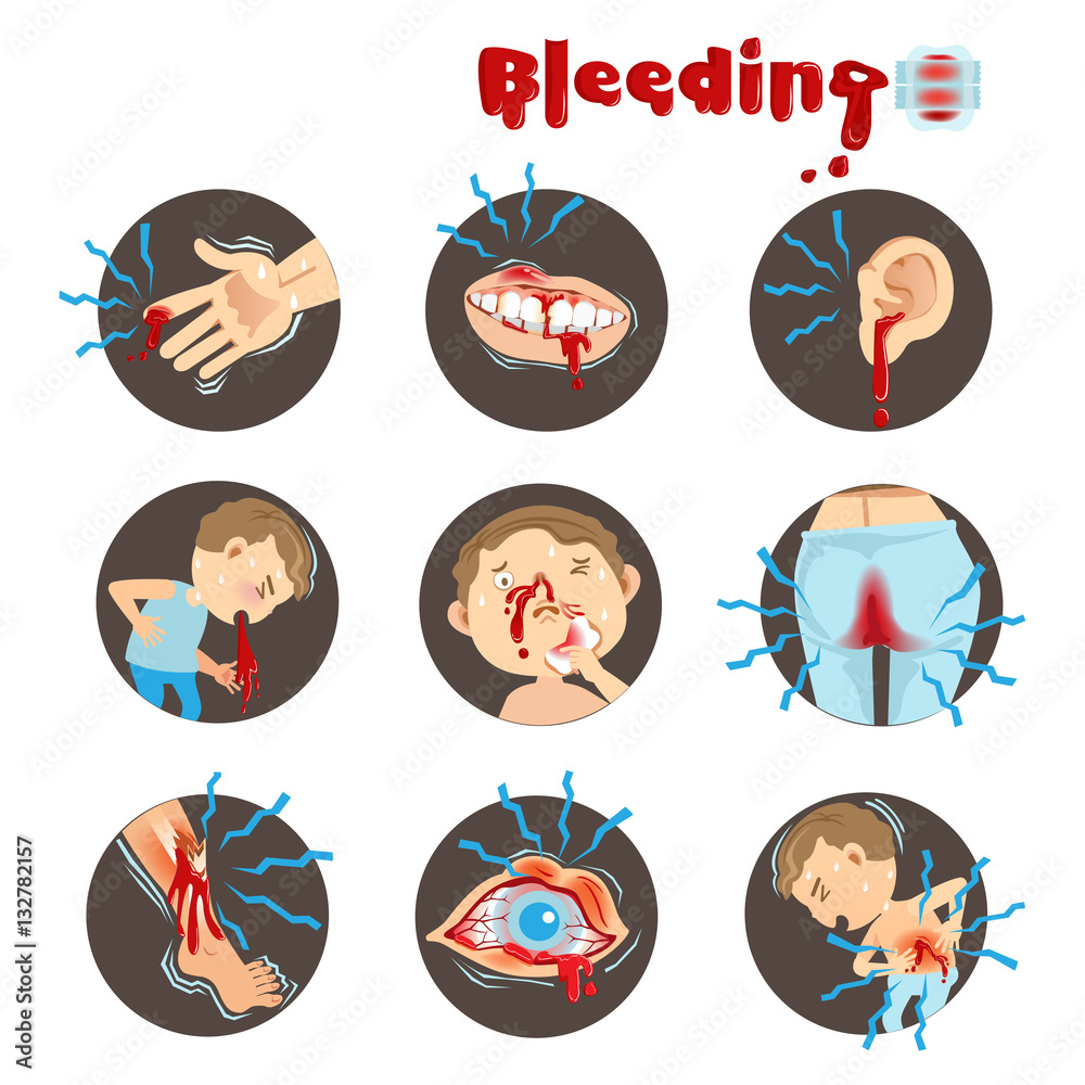 Cartoon Bleeding in a circle on a white background. Vector illustration ...