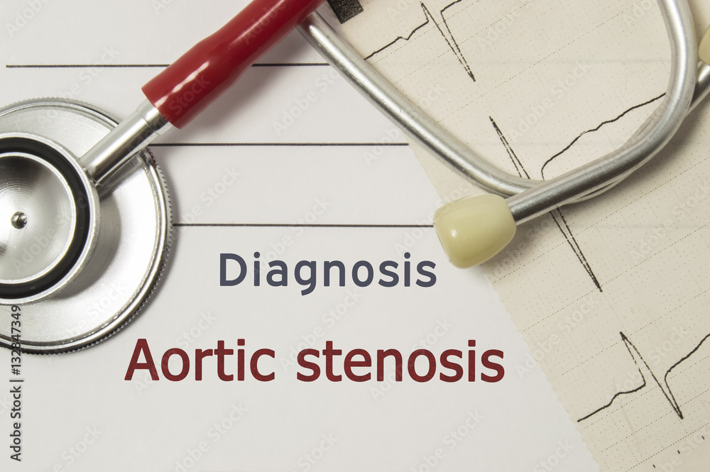 Cardiac diagnosis of Aortic Stenosis. On doctor workplace are red ...