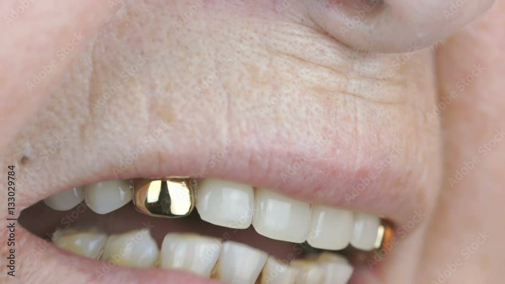 The old woman aged 80s smiling with false teeth. Close up Stock Video ...