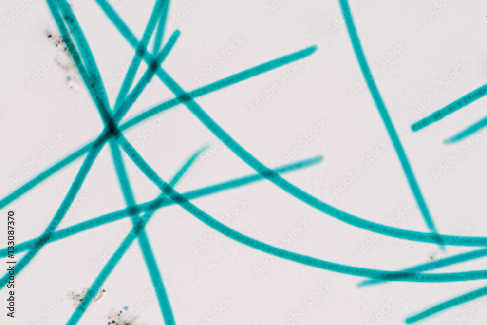 Oscillatoria 40x Labeled