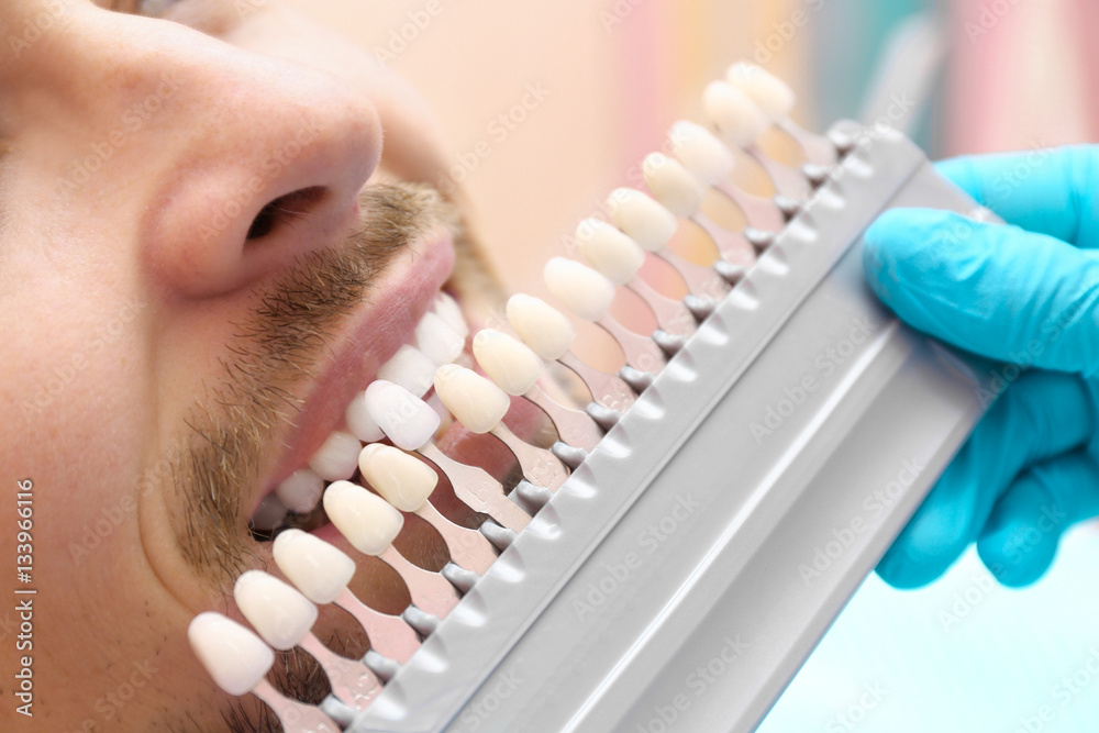 Dentist checking and selecting color of young man's teeth, closeup ...