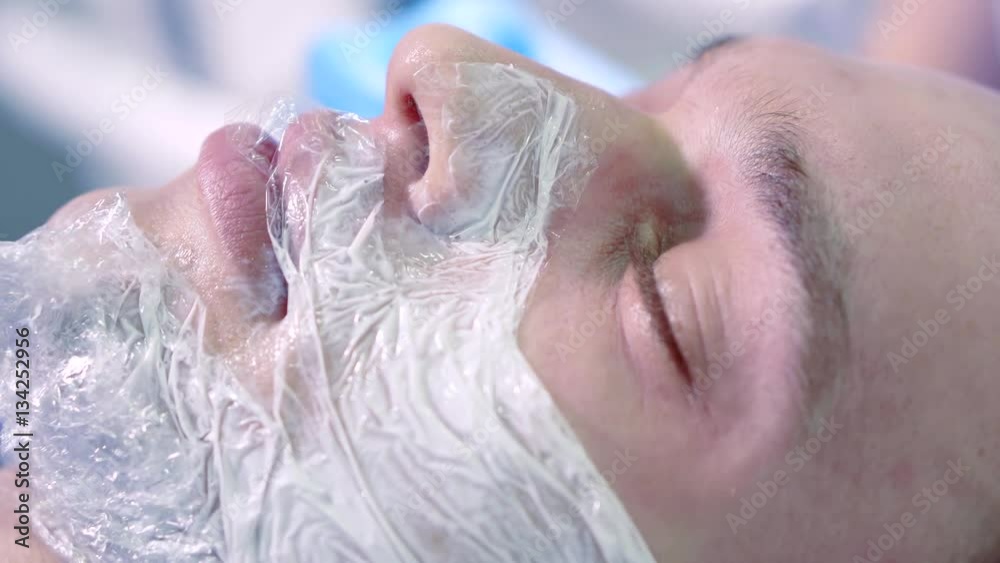 Procedure for laser resurfacing skin. Preparation of a male patient ...