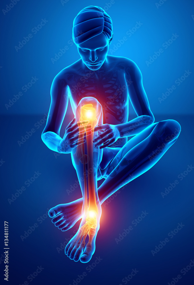 Female Leg joint pain ilustração do Stock | Adobe Stock