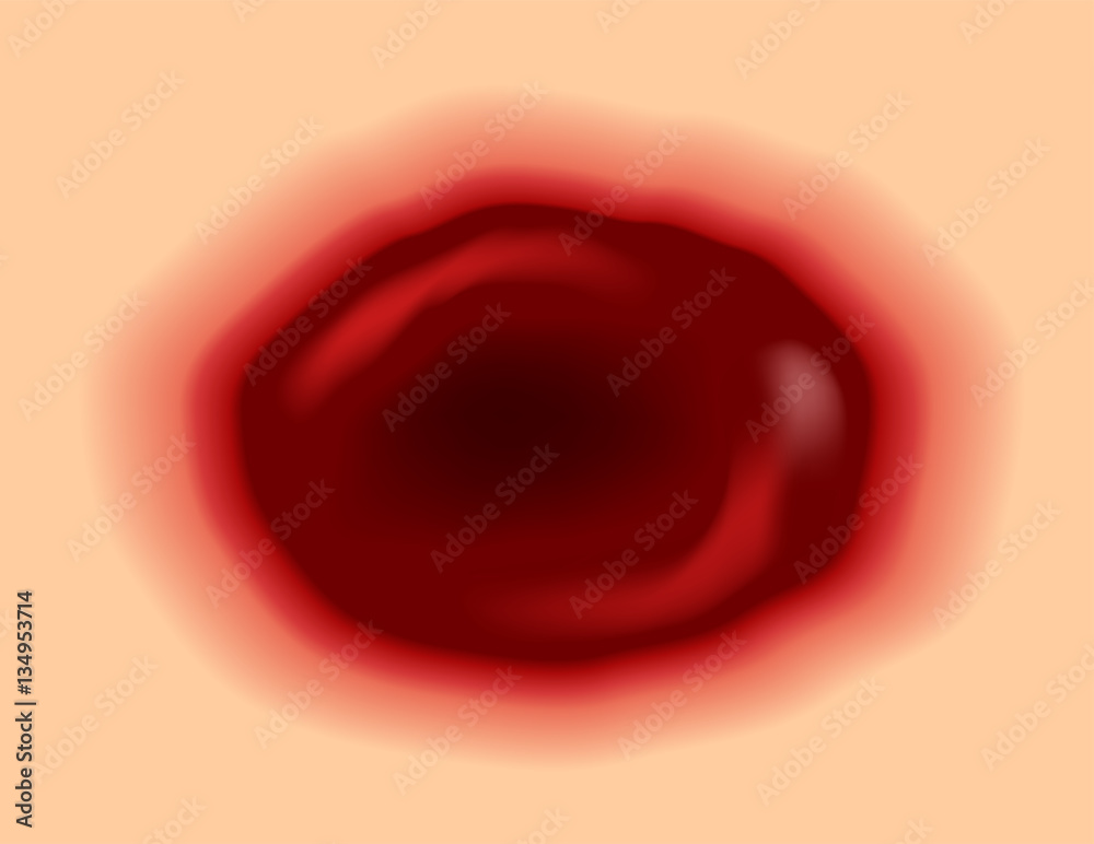 wound skin vector graphic . blood come out of wound Stock Vector ...