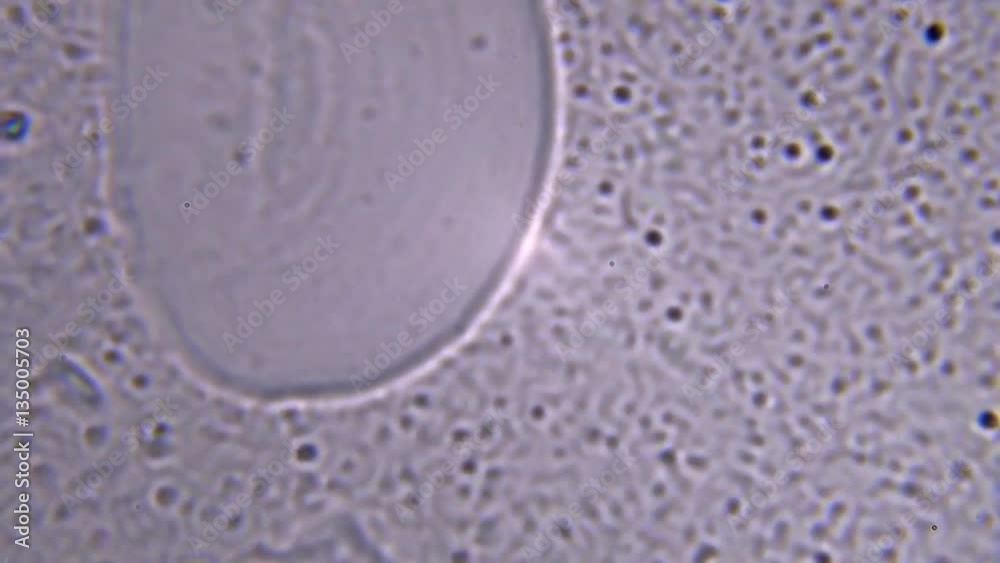 Stockvideon A colony of bacteria under a microscope. Magnification of ...