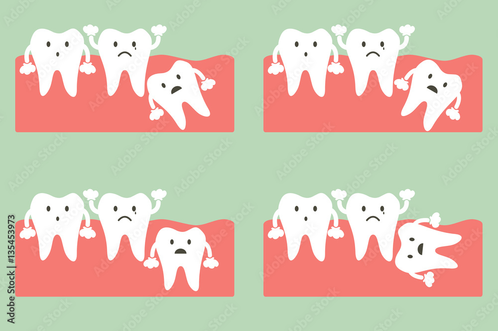 dental cartoon vector, set of wisdom tooth Stock Vector | Adobe Stock