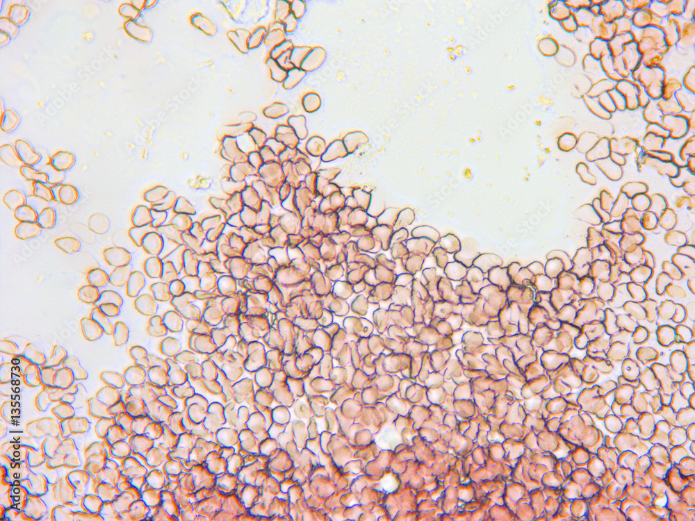 Blood cells microscopic view magnification x 400 Stock Photo | Adobe Stock