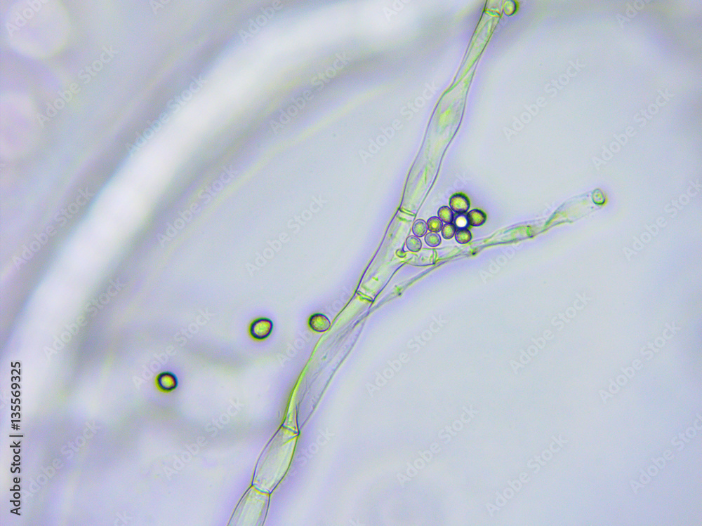 Mold microscopic view x400 magnification Stock Photo | Adobe Stock