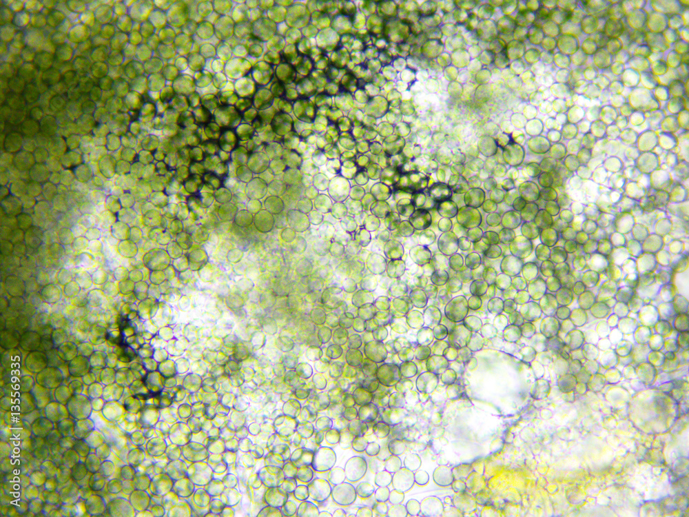 Mold microscopic view x400 magnification Stock Photo | Adobe Stock