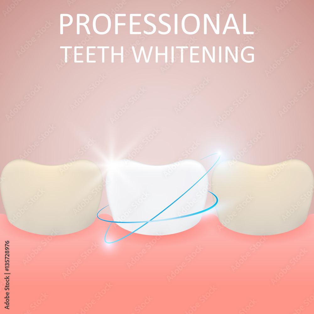 Professional Teeth Whitening, Healthy Tooth and yellow teeth, vector ...