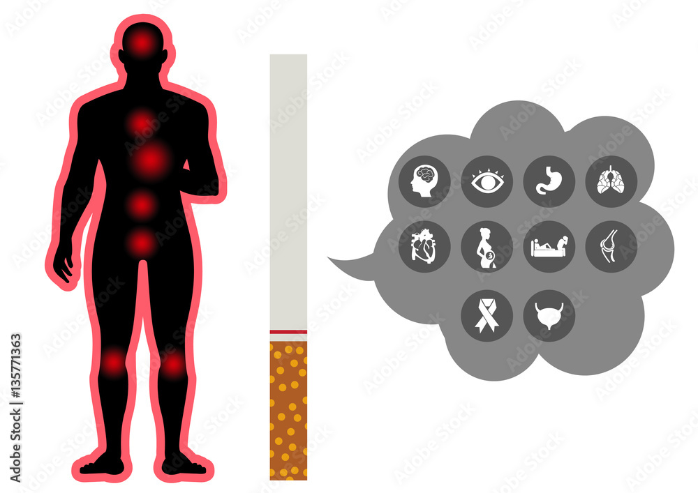 Health effects of cigarette smoking illustration. Lung cancer, high ...