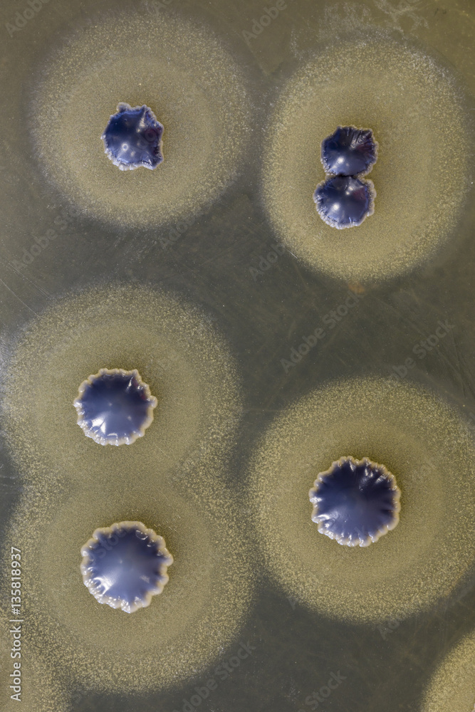 Staphylococcus aureus growing on Baird Parker agar showing black ...