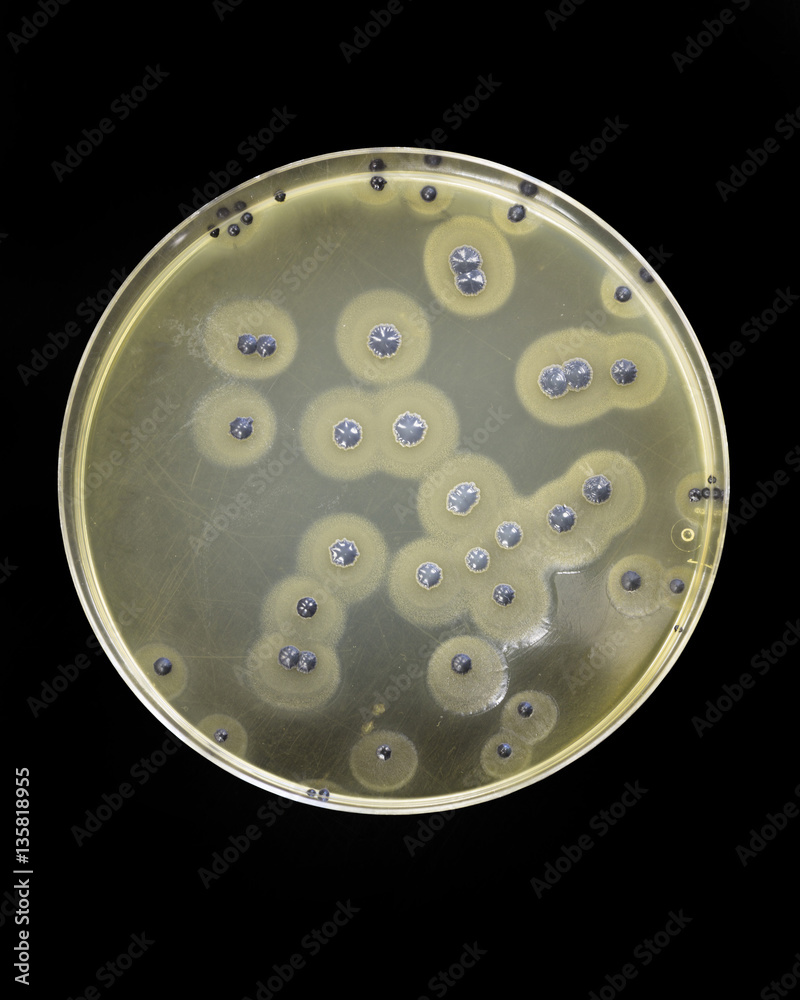 Staphylococcus aureus growing on Baird Parker agar showing black ...