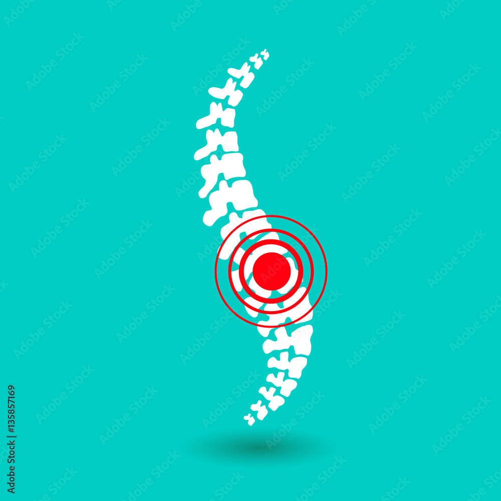 Vector human spine isolated silhouette illustration. Spine pain medical ...
