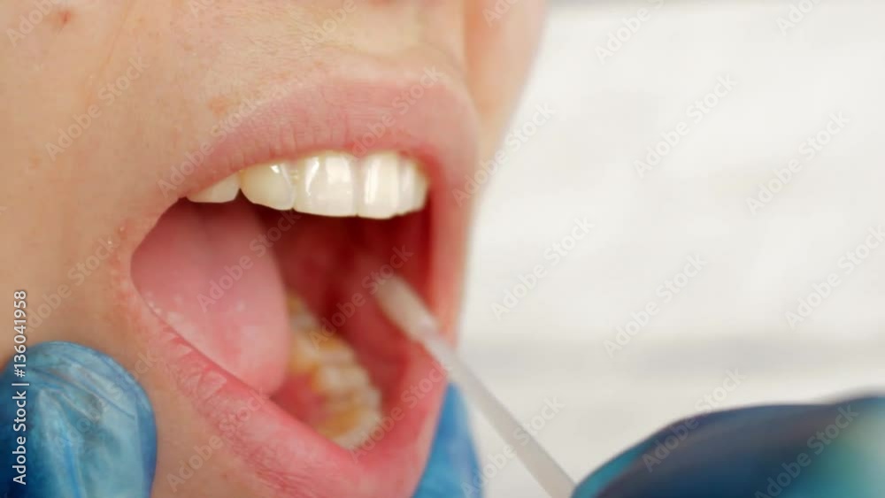 swabbing mouth, taking dna Stock Video | Adobe Stock