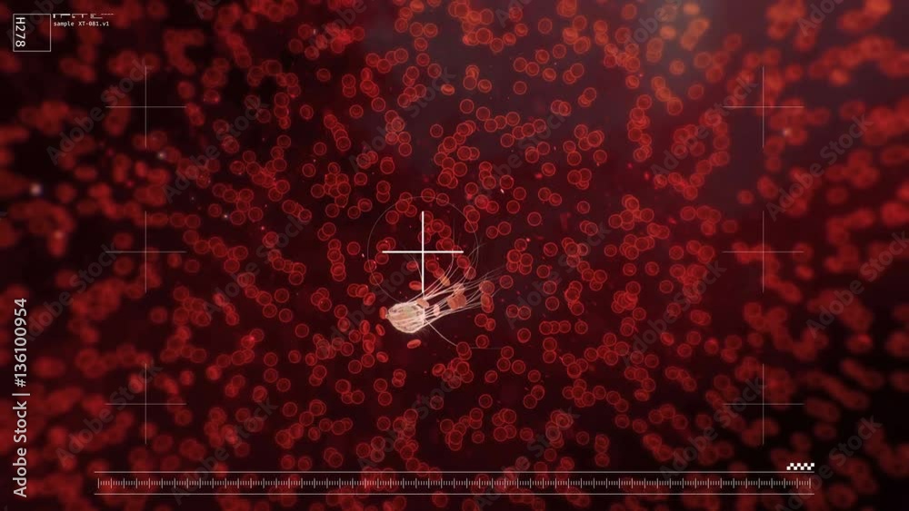 Macrophage among red blood cells under microscope, lab blood test ...