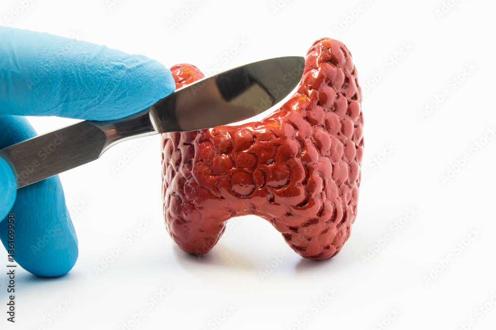 Thyroid surgery. Surgeon holding in gloved hand surgical scalpel over ...
