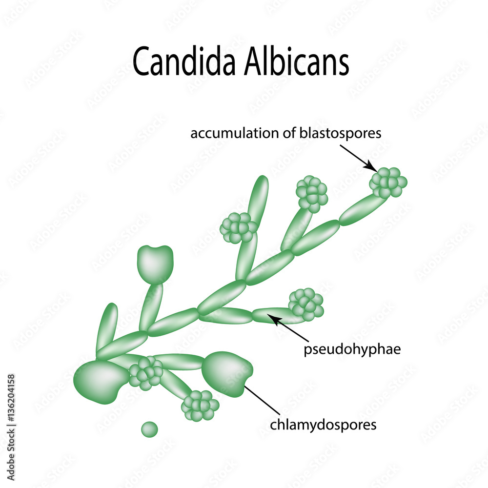 Structure of Candida albicans. Infographics. Vector illustration on ...