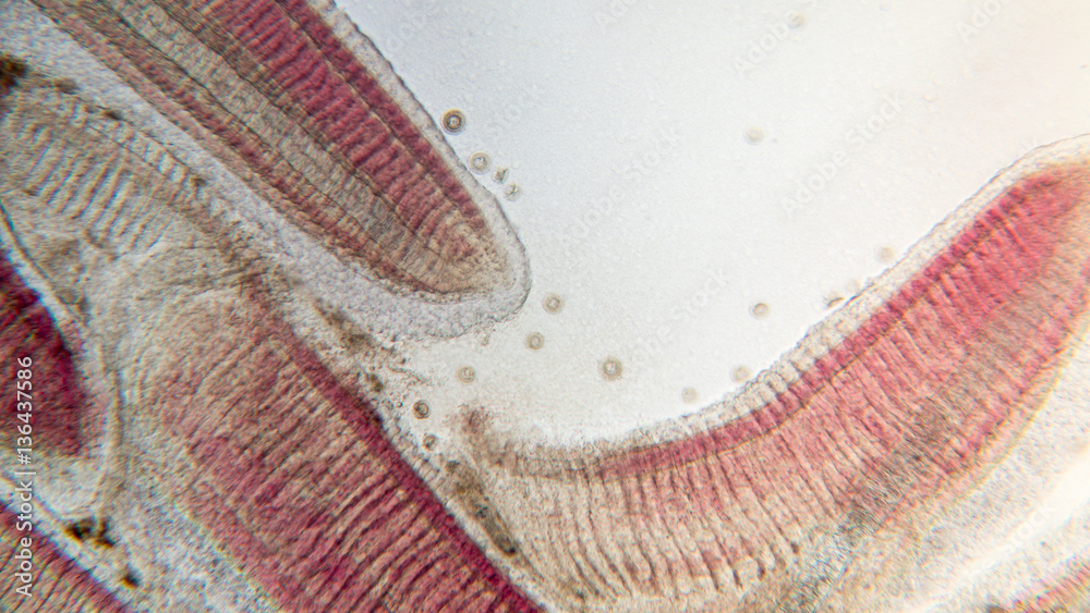 Gills of fish ,protozoa and Trichodina spp. under the microscope.(soft ...