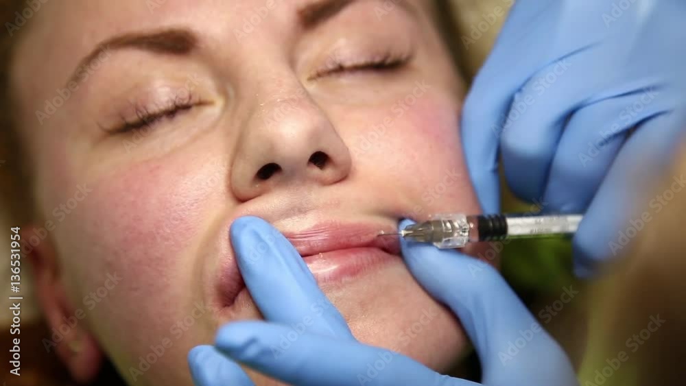 Young woman on lip Augmentation in a clinic. Anesthetic injection ...