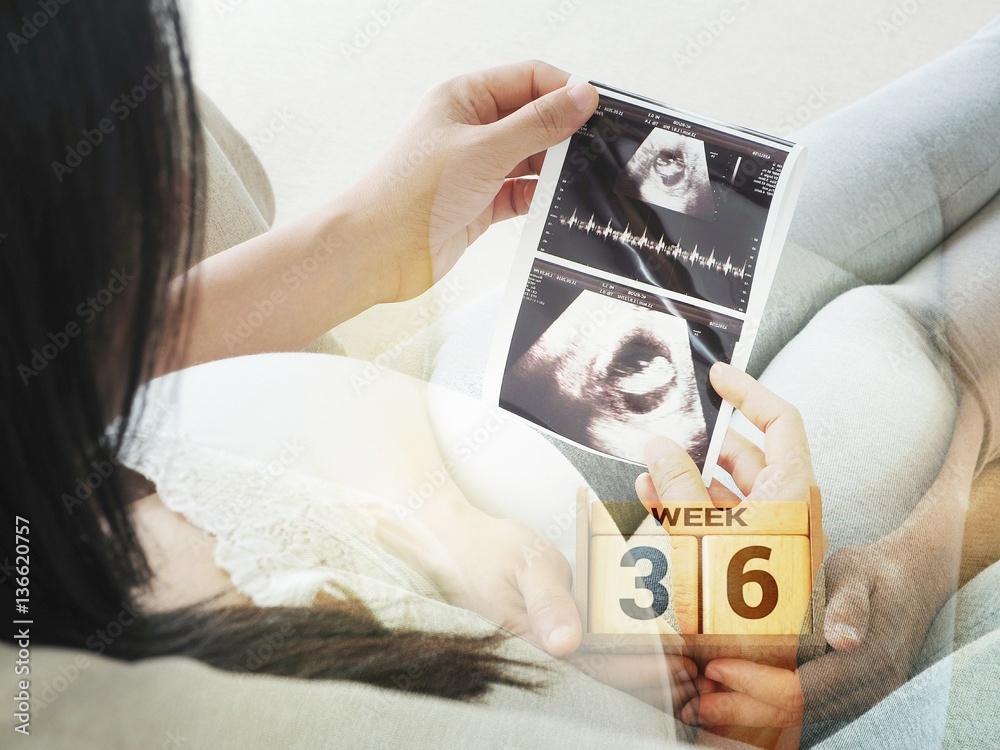 Double exproure of Pregnant woman holding ultrasound scan and calendar ...