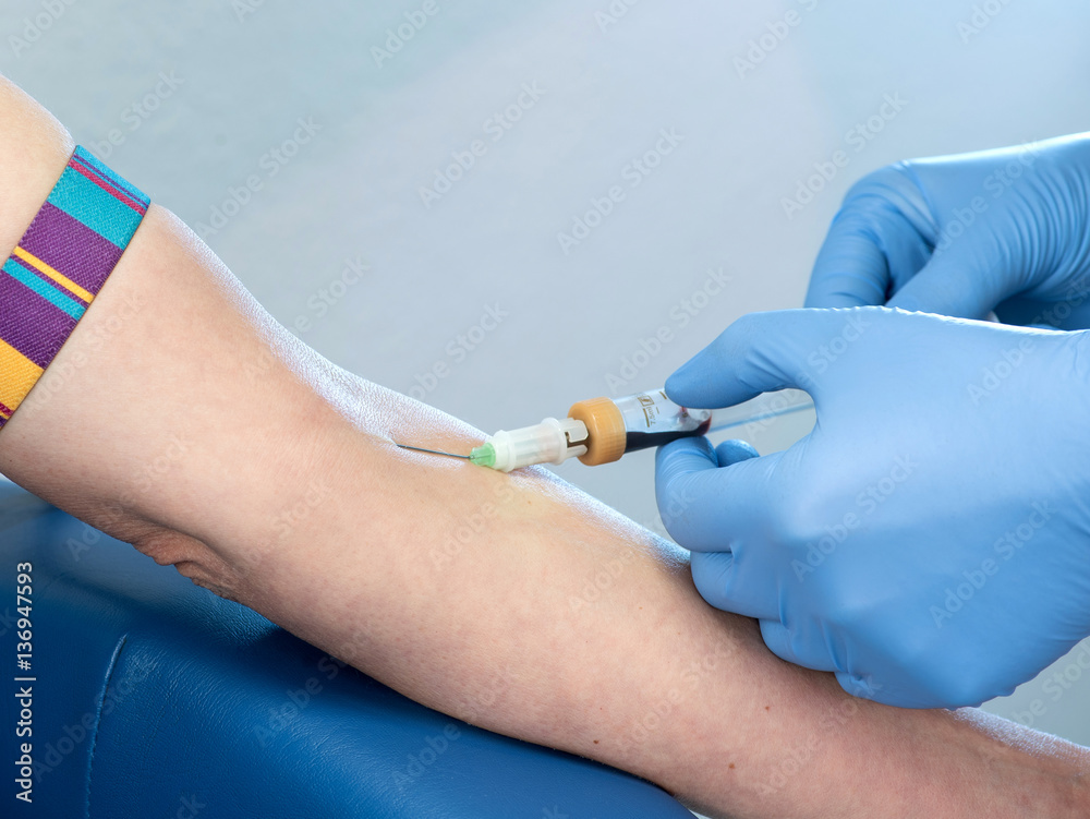 venöse Blutentnahme in der Ellenbeuge in der Arztpraxis Stock-Foto ...