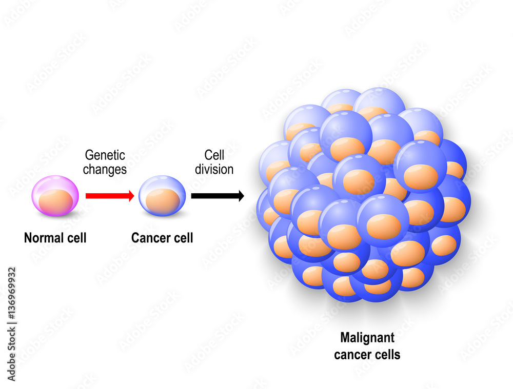 Normal human cell, cancer cell and malignant cancer Stock Vector ...