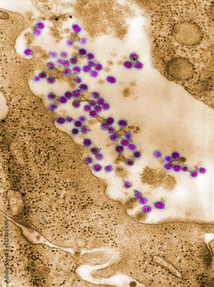 Foto de Full frame microscopic image of rubella virus virions in the ...