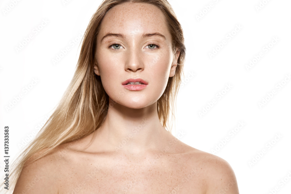 Beautiful Woman With Freckles On Her Face With A Light Sensitive Skin