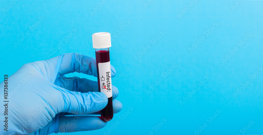 Sample of blood in vitro to the hand in glove Stock Photo | Adobe Stock
