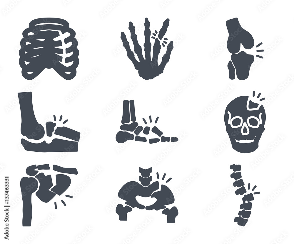 Broken Bones Human Skeleton Silhouette Icon Stock Vector | Adobe Stock