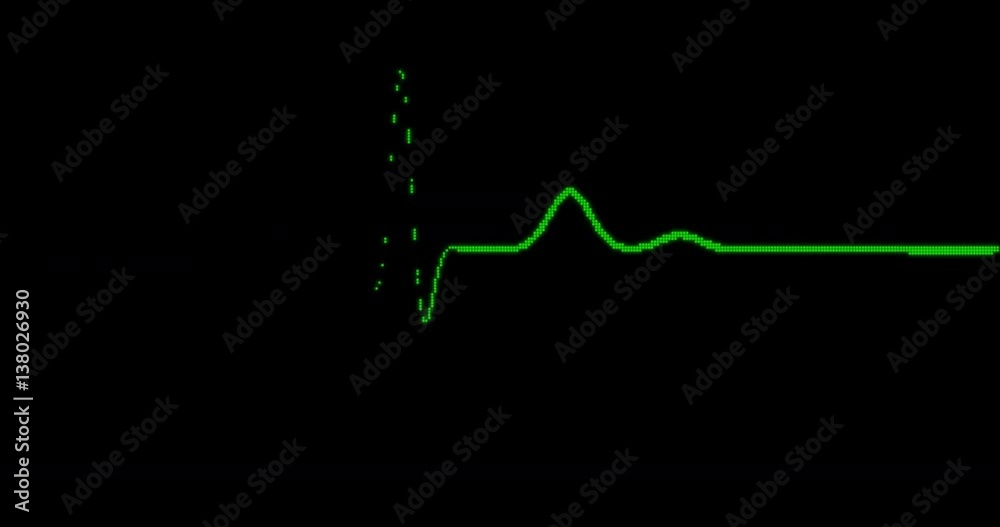 Video „Loopable: EKG Line / EKG Monitor / EKG Machine / Heart Health ...