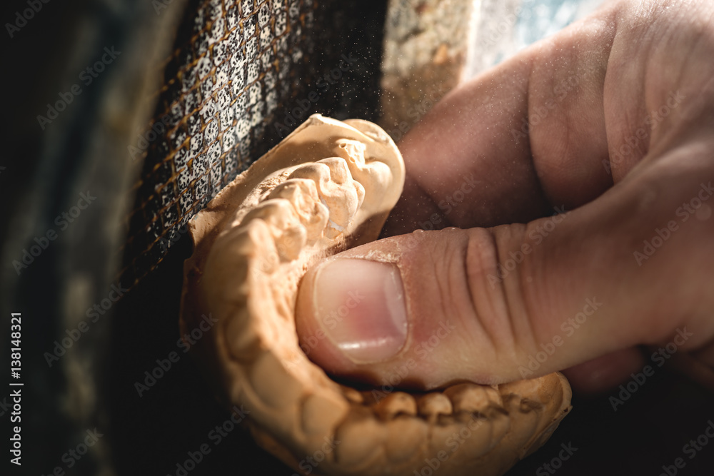 Dental prosthesis, artificial tooth, prosthetic, hands working on the ...
