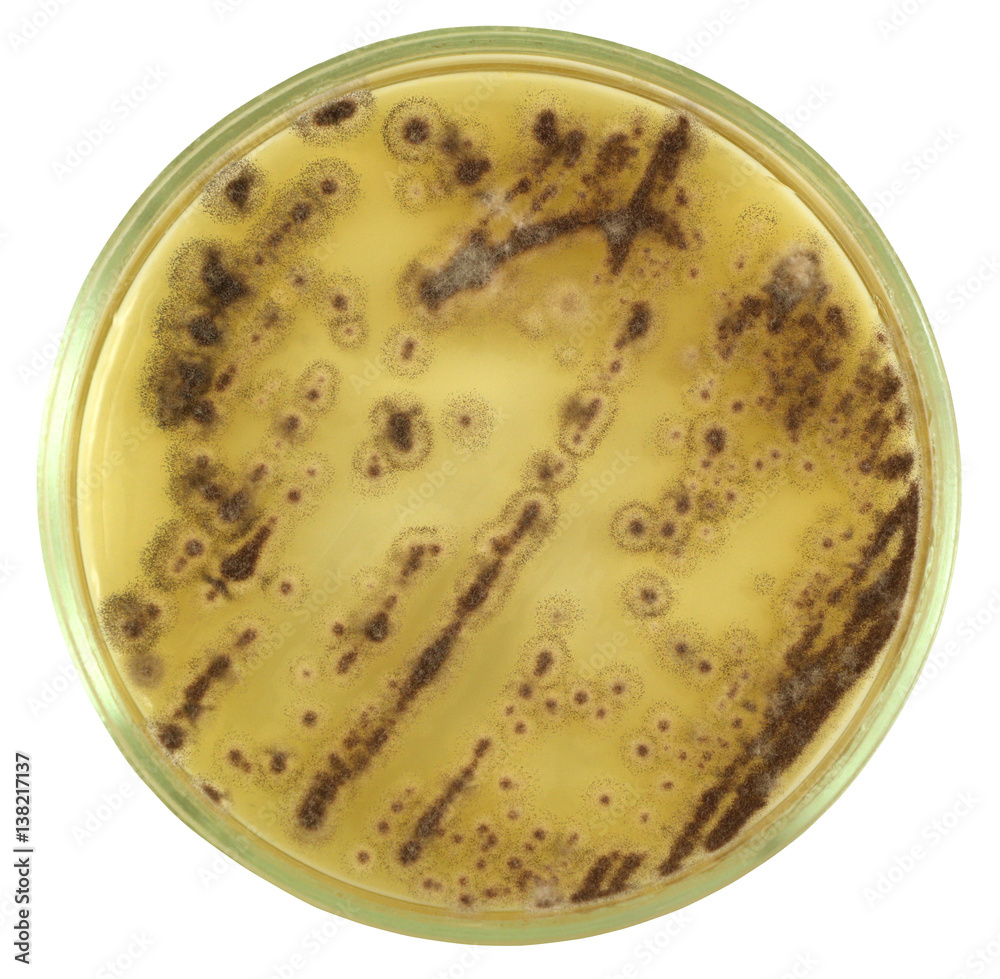 Colonies of pathogenic fungus Mucor from air of a biodamaged building ...