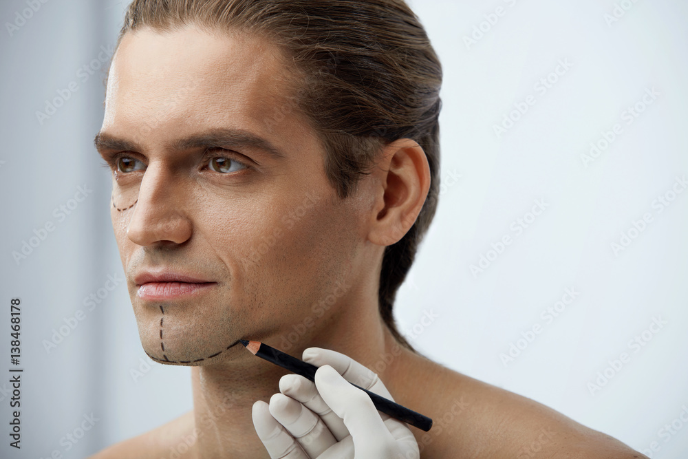 Handsome Man With Black Lines On Face Before Plastic Surgery Stock ...