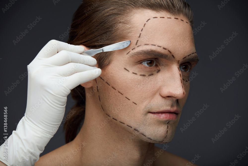 Man With Black Lines On Face Before Plastic Surgery Operation 스톡 사진 ...